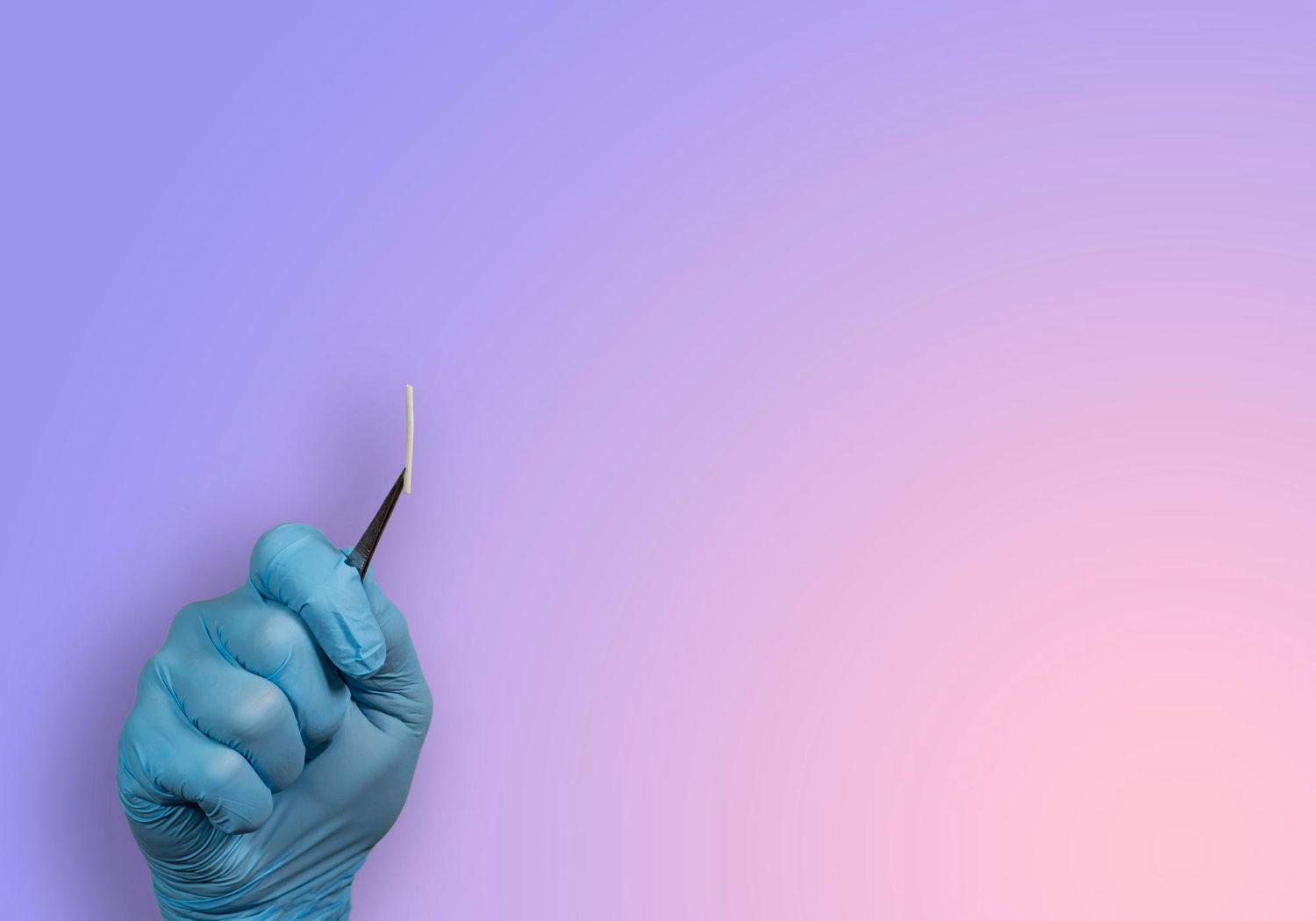 Implanon: o que é, como funciona e vantagens do implante